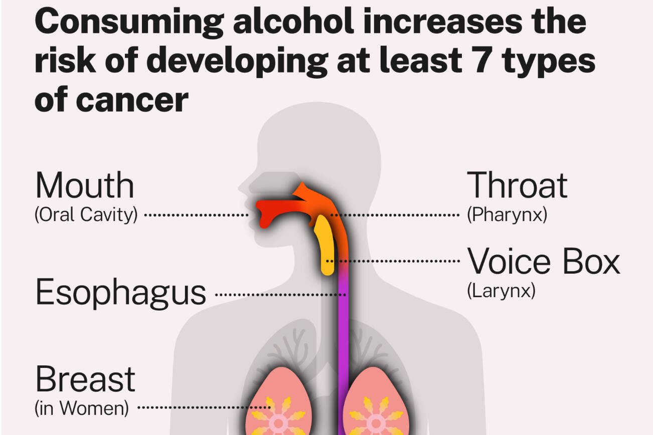 Alaska to require retailers to post warnings about alcohol cancer risk ...